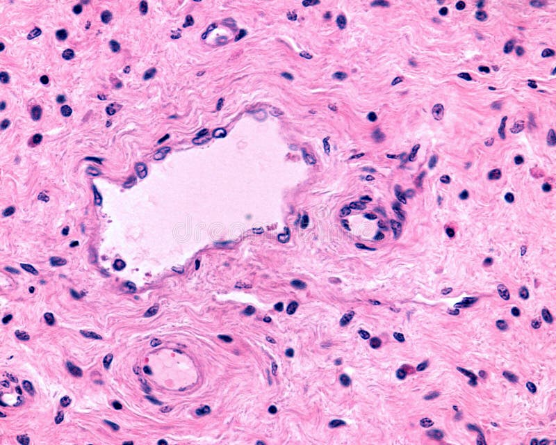 Connective tissue. Venules stock photo. Image of histological - 231621254