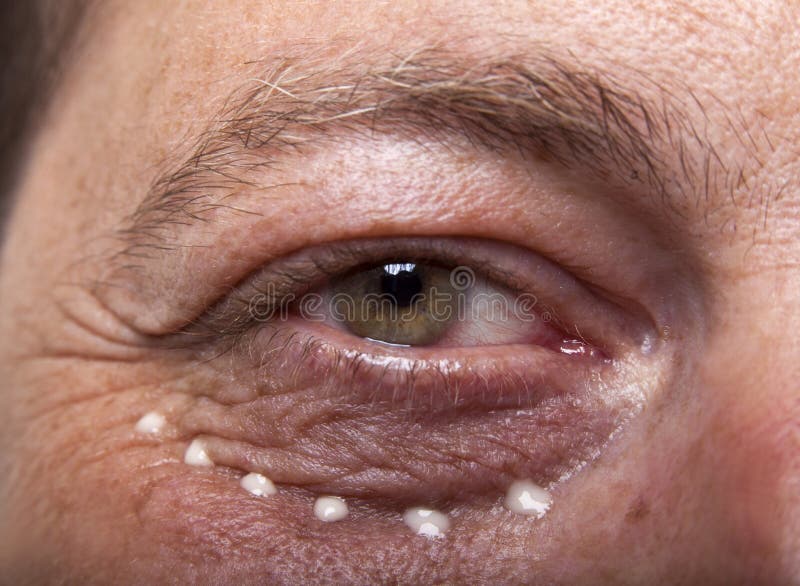 Verjonging stock afbeelding. Image of groen, levensstijl - 34102847