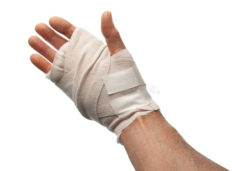 Verletzte Hand, getrennt stockbild. Bild von krankheit - 18696817