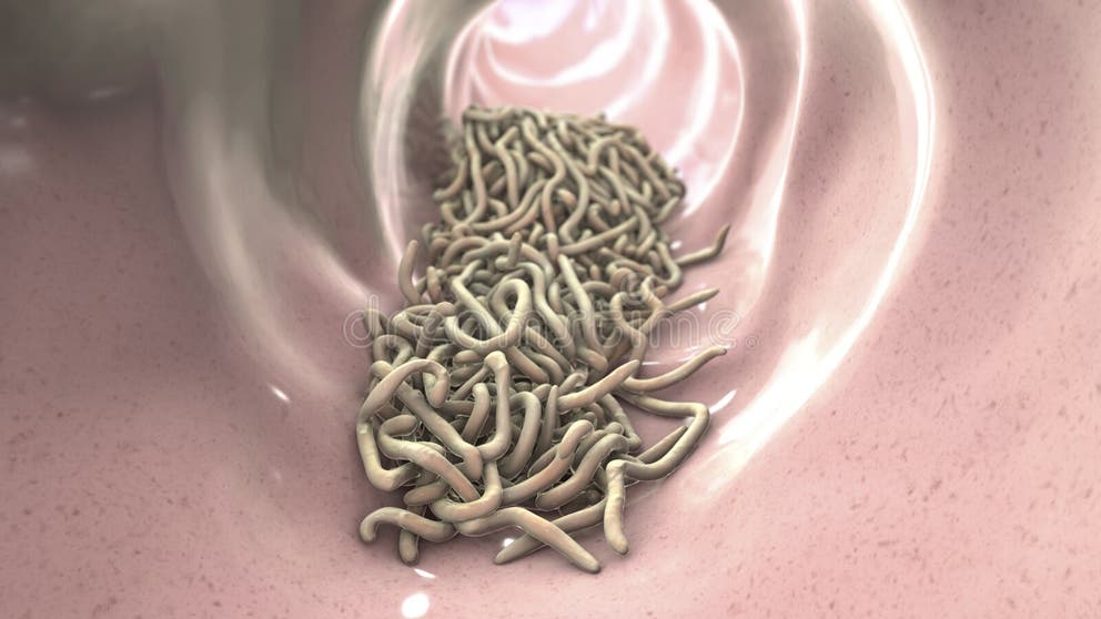 Vermes Parasitas No Lúmen Do Intestino Ilustração Stock - Ilustração de ... Vermes Parasitas No Lúmen Do Intestino Ilustração Stock - Ilustração de ...