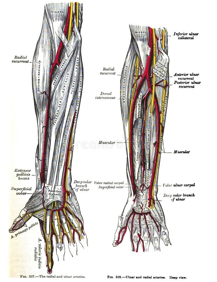 Right Ulnar Artery