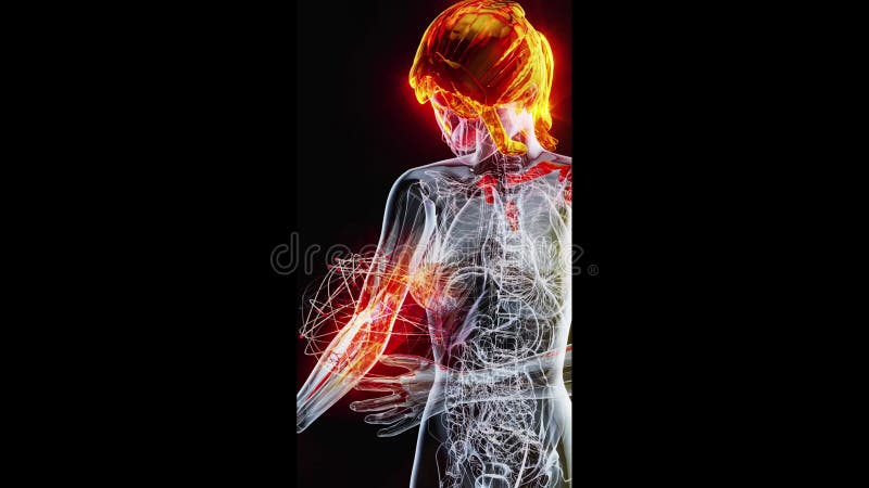 Vertical Animation of Elbow Pain Stock Footage - Video of physiology ...