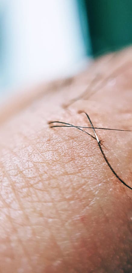 Vertical Macro Shot of a Human Body Hair Stock Image - Image of human ...