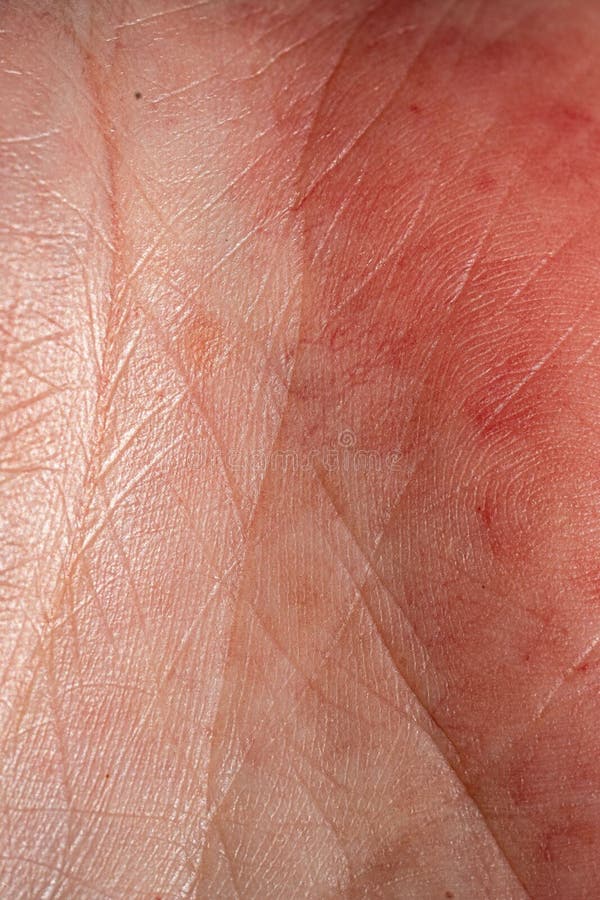 Vertical Macro Shot of the Human Skin Texture. Stock Photo - Image of ...