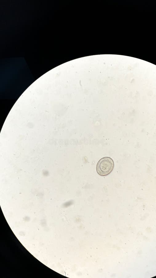 Vertical Shot of a Parasite Stock Image - Image of animal, parasite ...