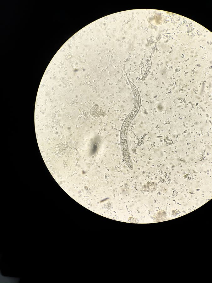 Vertical Shot of a Parasite Stock Image - Image of light, macro: 258902541