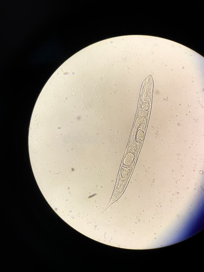 Vertical Shot of a Parasite Stock Image - Image of color, pattern ...