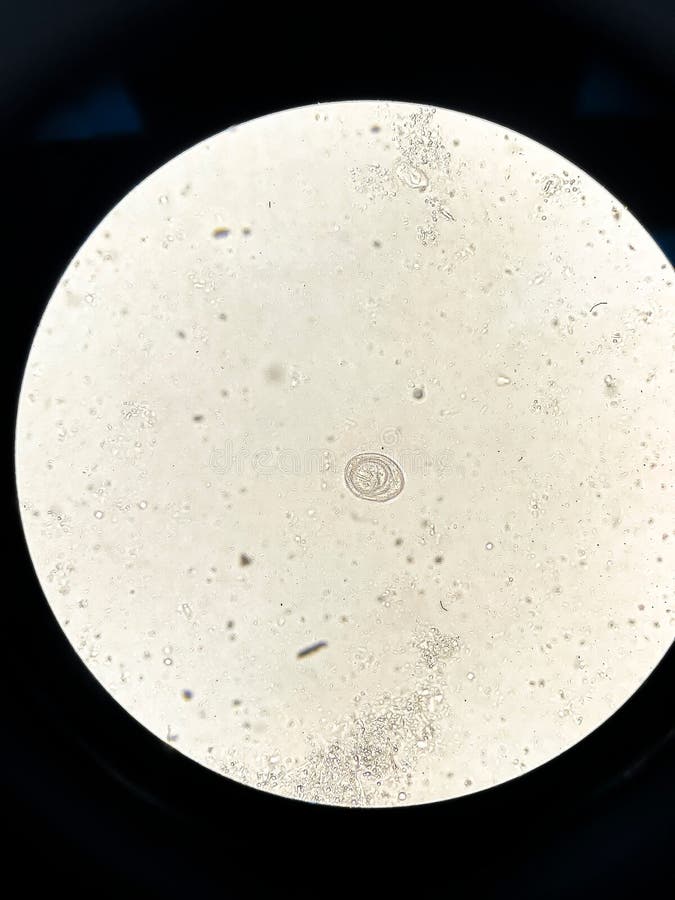 Vertical Shot of a Parasite Stock Image - Image of pattern, textured ...