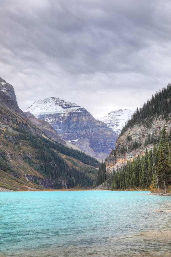 Vertical of a View of Lake Louise Near Banff, Canada Stock Image ...