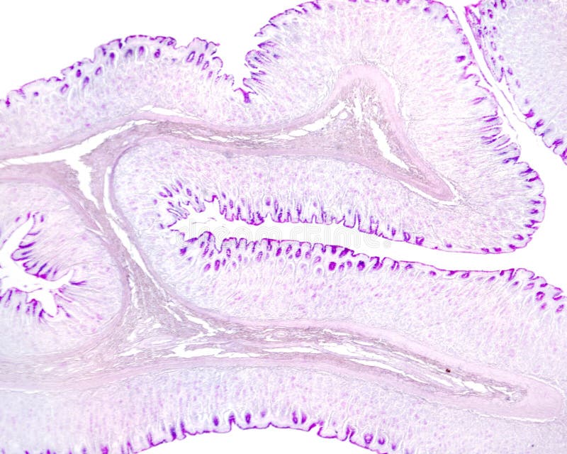 Gastric mucosa. PAS method stock photo. Image of stomach - 310913694