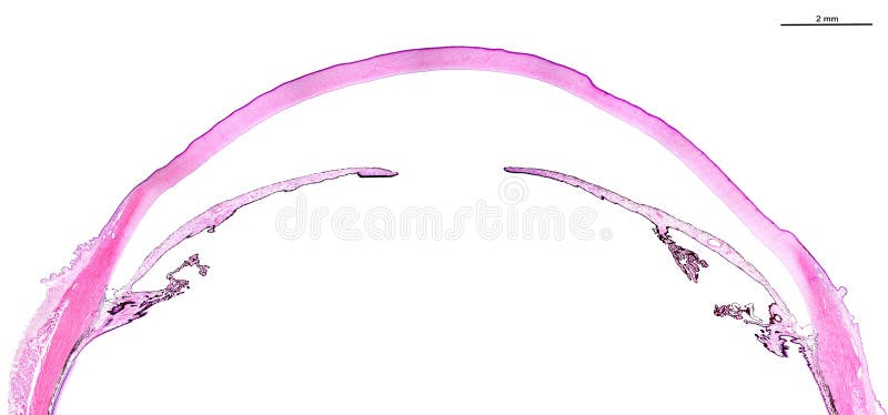 Eye. Anterior pole stock photo. Image of retina, pigmented - 303600406