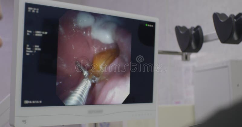 A Veterinarian Performs an Endoscopic Procedure, Carefully Removing a ...