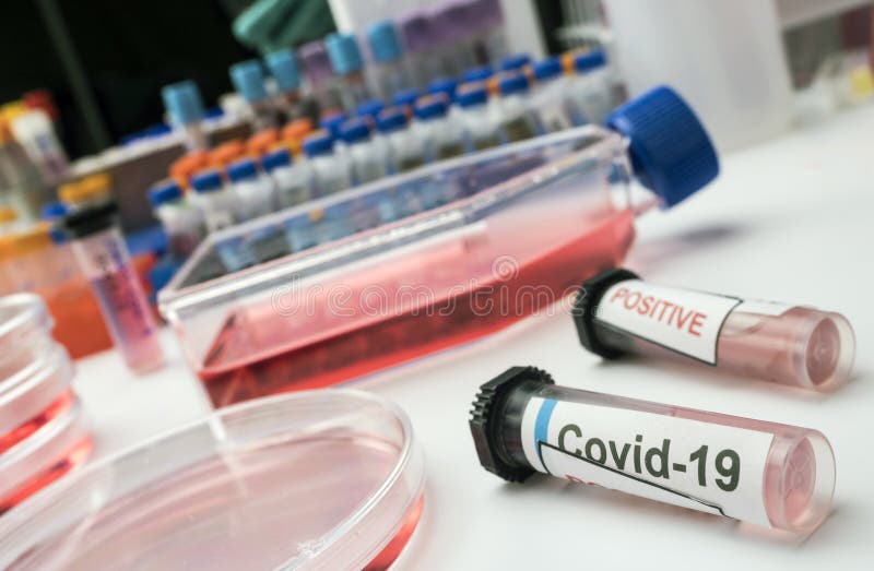 Vial Pcr of SarsCov2 Coronavirus, Stock Image - Image of infection ...