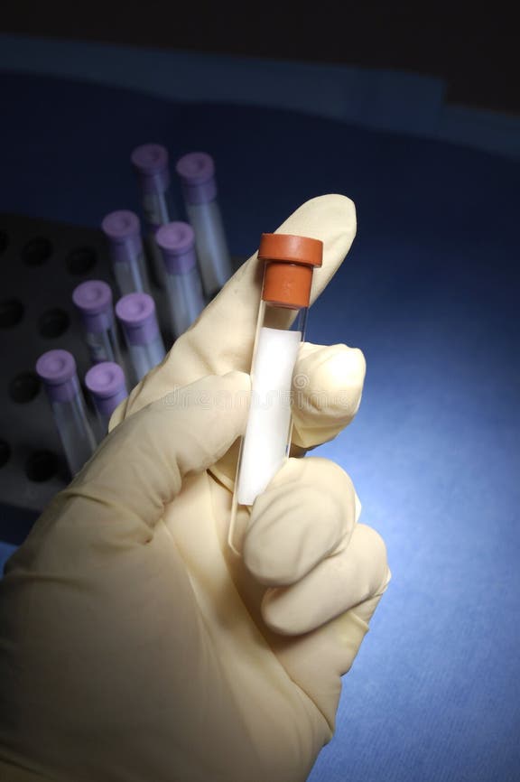 Vials for Blood or Chemicals Stock Photo - Image of disease, imunology ...