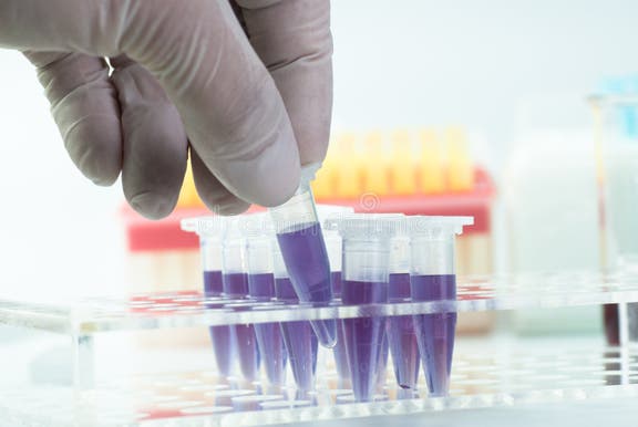 Vials and hand stock photo. Image of biochemistry, rack - 26178238