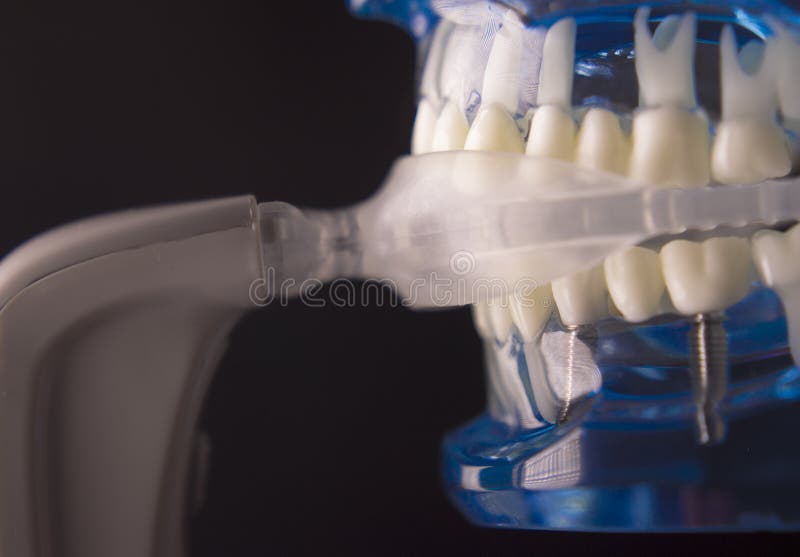 Vibrating Dental Device with Invisible Orthodontics Stock Photo - Image ...