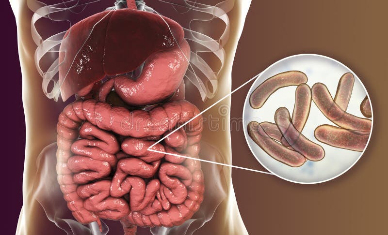 Vibrio Cholerae Bacteria in Small Intestine Stock Illustration ...