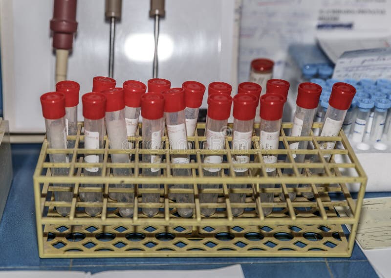 View of a Group of Laboratory Tubes with Red Plugs Stock Image - Image ...