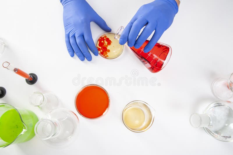 View of a Human Hands in the Laboratory while Performing Experiments ...