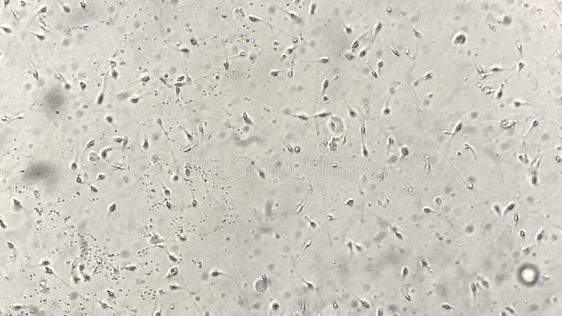 View At Human Sperm Under Microscope In Lab Stock Video Video Of Dish