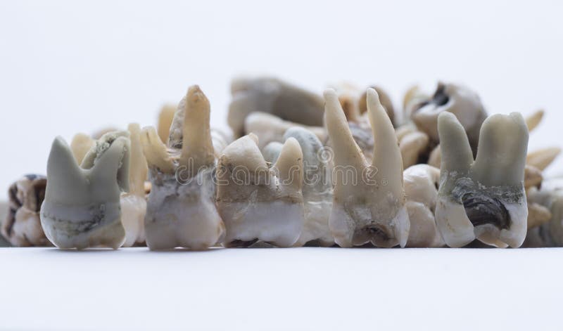 Close Up Shot of Extracted Human Tooths. Stock Image - Image of ...