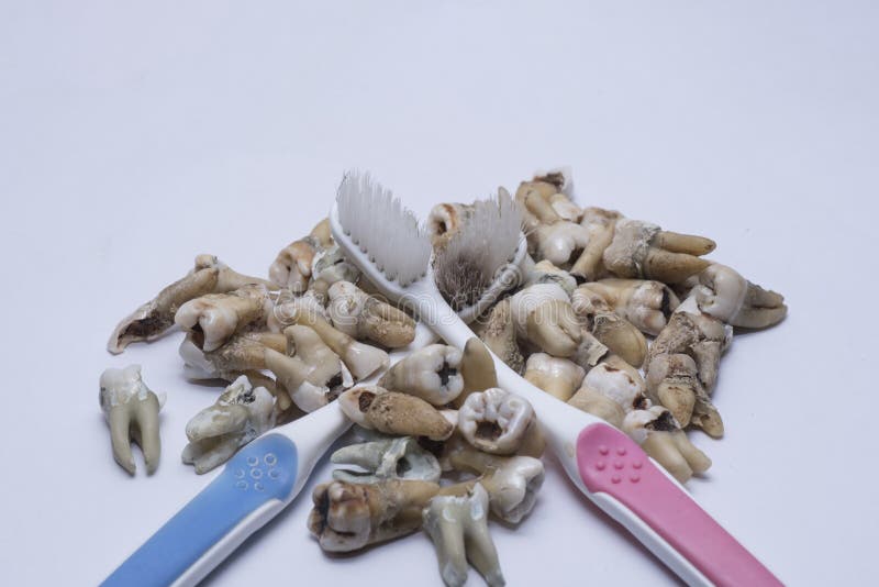 Close Up Shot of Extracted Human Tooths. Stock Image - Image of anatomy ...