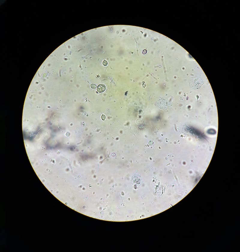 View in the Microscope on Trichomonas STD Stock Image - Image of ...