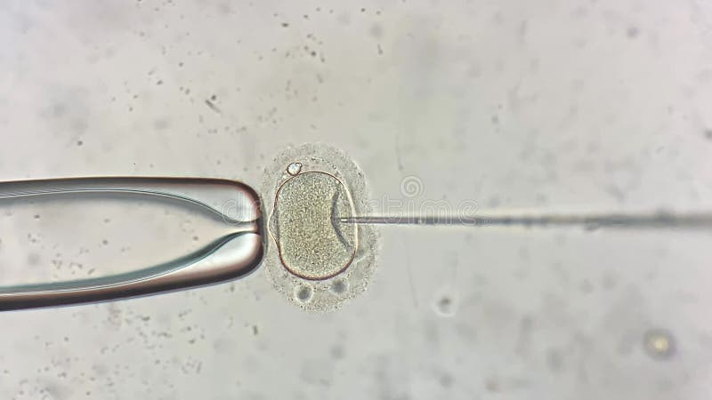 View through Microscope at in Vitro Fertilization Process Stock Video ...