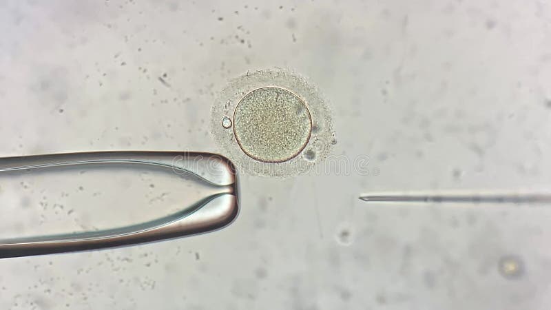 View through Microscope at in Vitro Fertilization Process Stock Video ...
