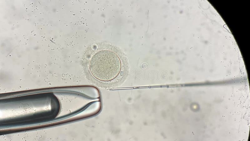 View through Microscope at in Vitro Fertilization Process Stock Footage ...