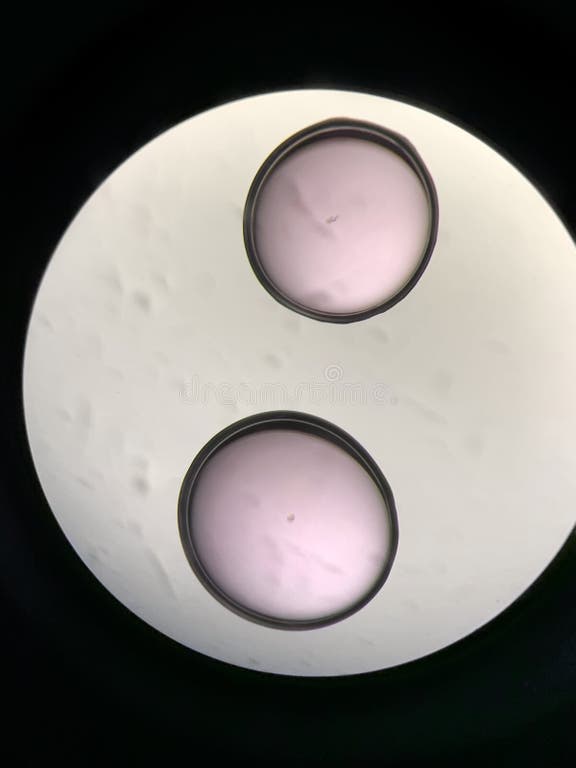 View through Microscope at in Vitro Fertilization Process Stock Photo ...