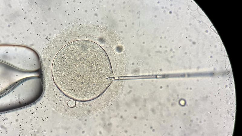 View through Microscope at in Vitro Fertilization Process Stock Footage ...