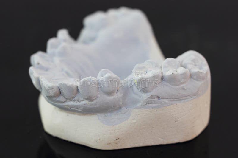 View of Plaster Model of Lower Front Teeth Stock Image - Image of front ...