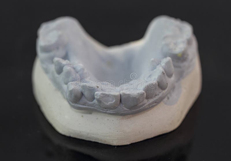Plaster Model Of Teeth On A Work Table,a Dental Technician Makes A ...
