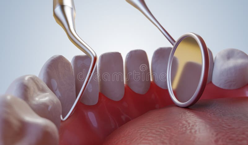 View on Teeth from Inside of Mouth during Examination at the Dentist ...