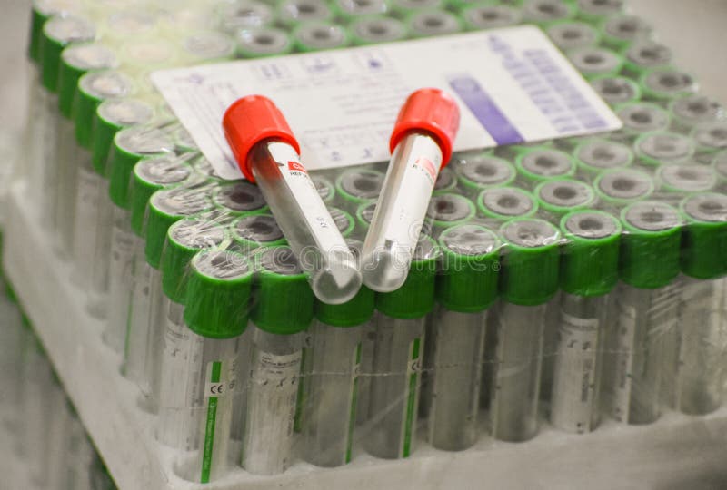 View of Testing Medical Vials Useful in Various Blood Sample ...