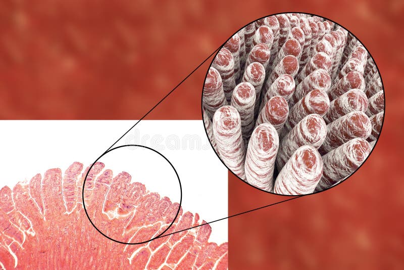 Villi of small intestine stock illustration. Illustration of microscopy ...