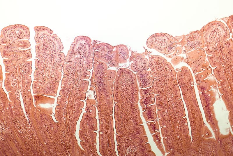 Villi of small intestine stock photo. Image of hematoxilin - 78880044