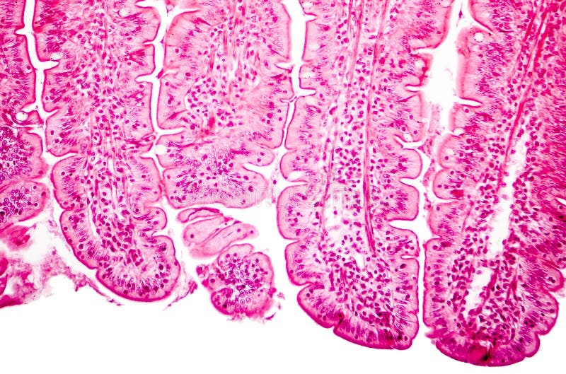 Villi of Small Intestine, Light Micrograph Stock Image - Image of ...