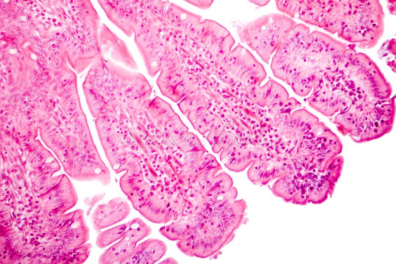 Villi of Small Intestine, Light Micrograph Stock Image - Image of macro ...