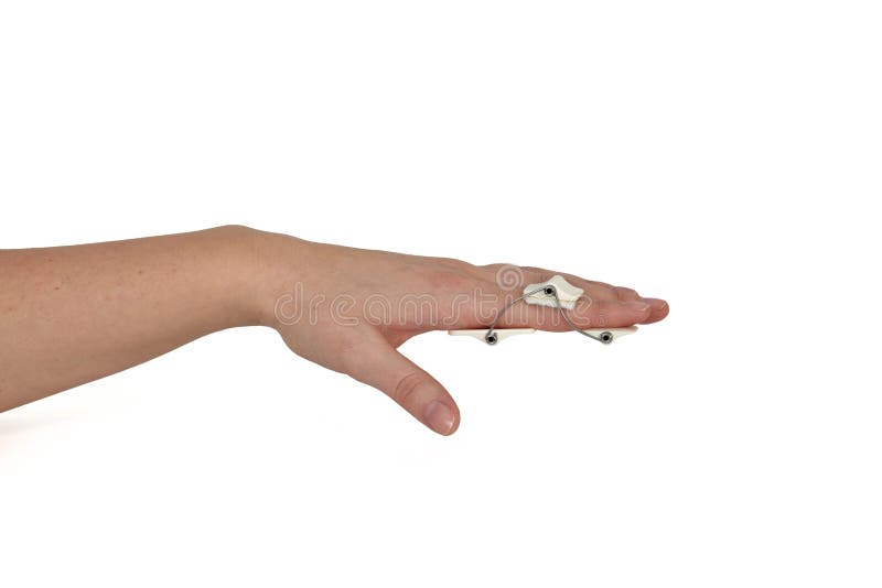 Vinger in een splinter. stock afbeelding. Image of gezondheid - 28900147