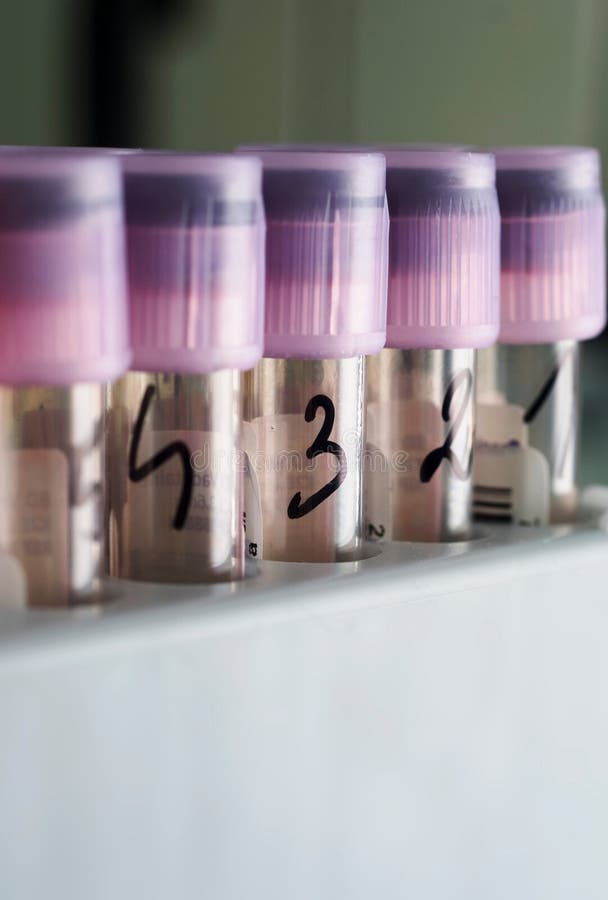 Blood in Test Tubes in Real Lab Stock Photo - Image of medical ...