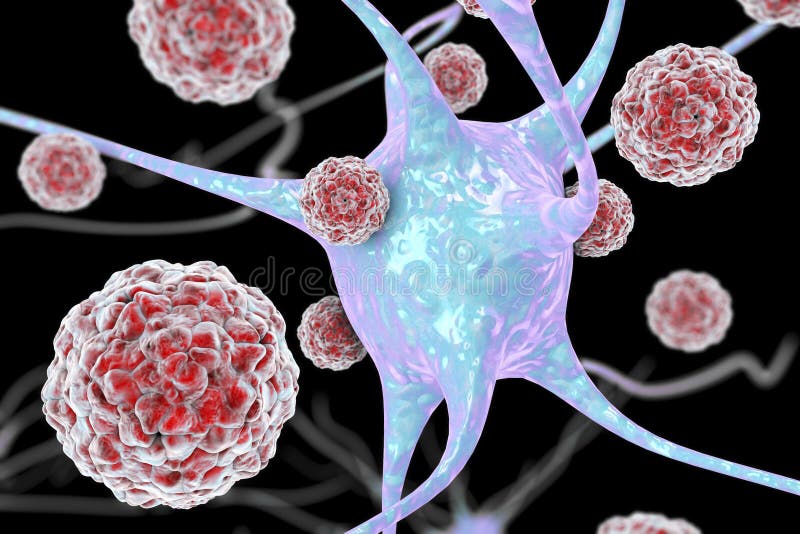 Viral infection of brain stock illustration. Illustration of closeup ...