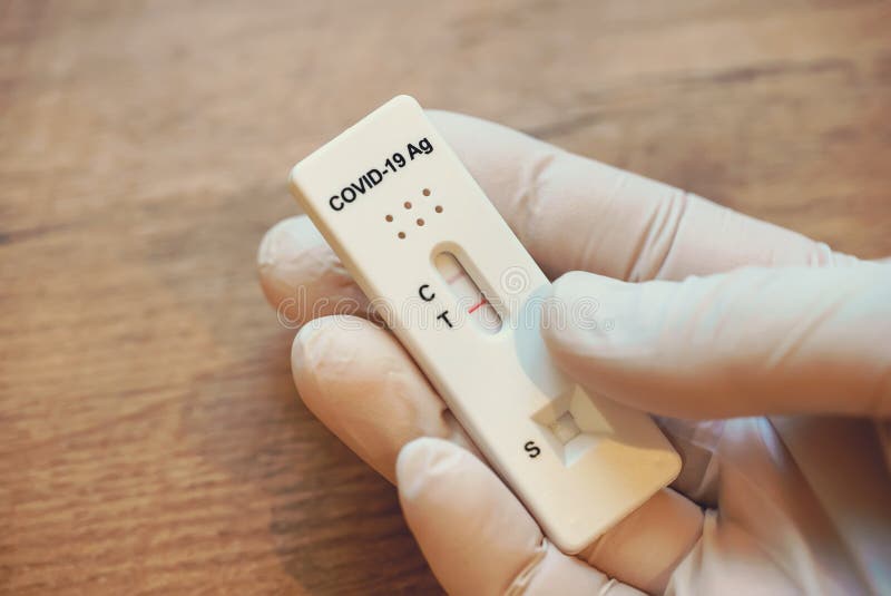 Virologist Showing Positive Antigen Rapid Test Stock Image - Image of ...