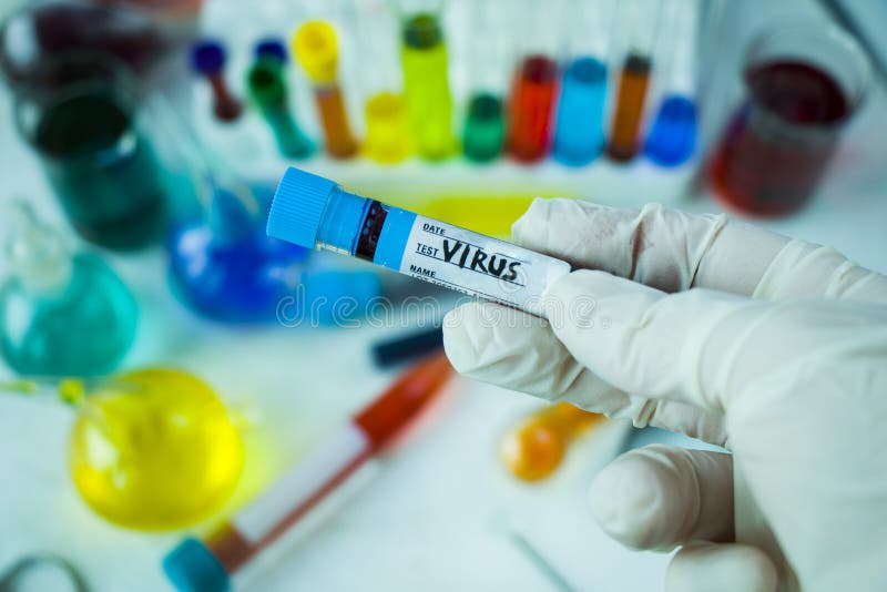 Virus Blood Test Tube in Laboratory, Glassware and Reagents Stock Image ...