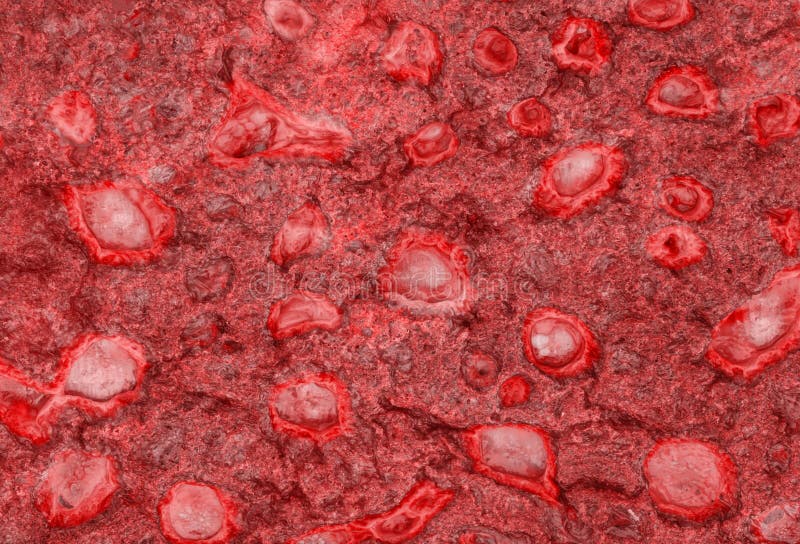 Virus Cell Chinese Pathogen Respiratory Flu Coronavirus COVID-19 Under ...