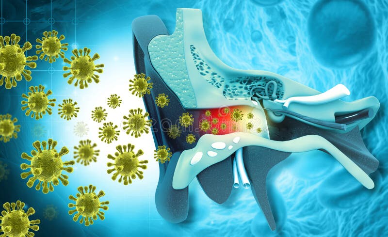 Virus Infection in the Human Ear Stock Illustration - Illustration of ...