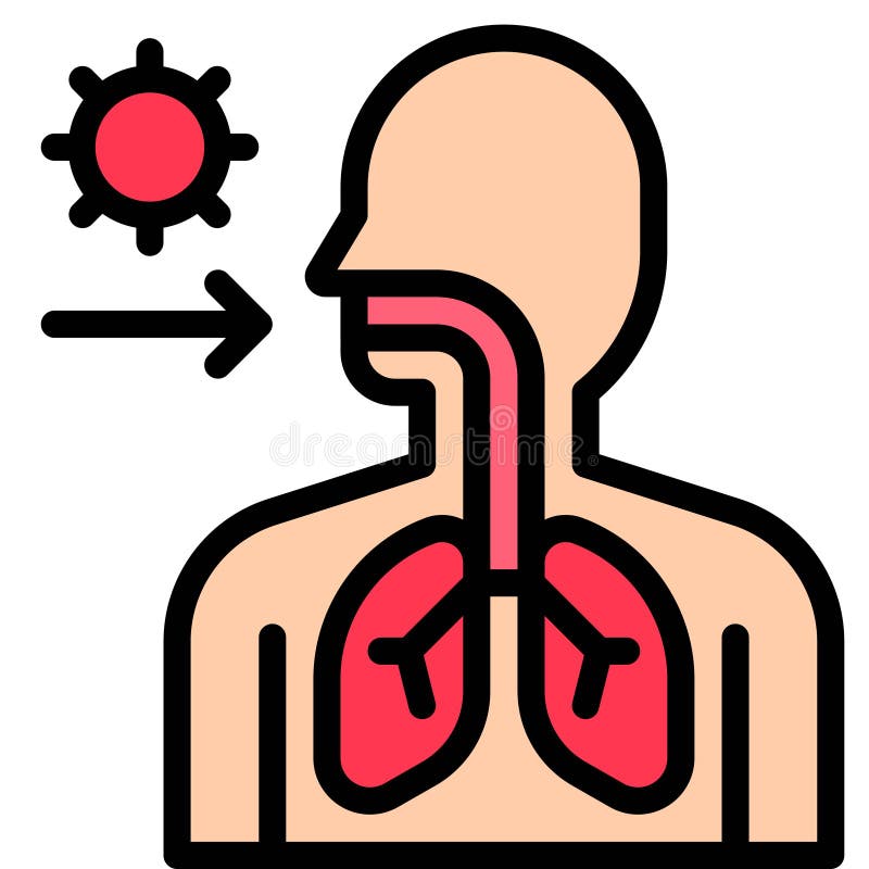 Pneumonia Vector Illustration. Labeled Diagram with Causes and Symptoms ...
