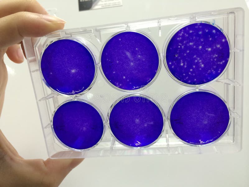 Virus staining stock image. Image of experiment, science - 94423451