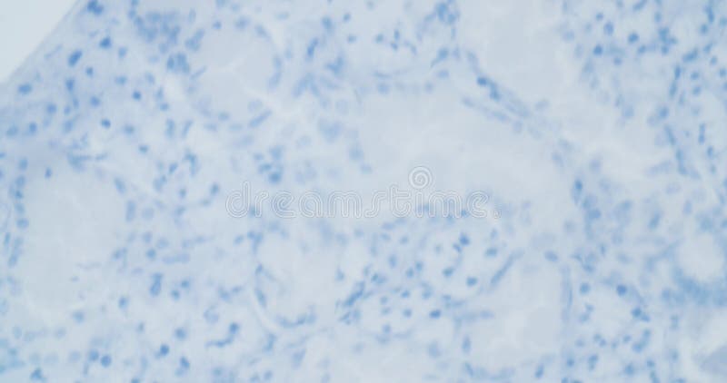 Virus Structure Under a Microscope Stock Photo - Image of influenza ...